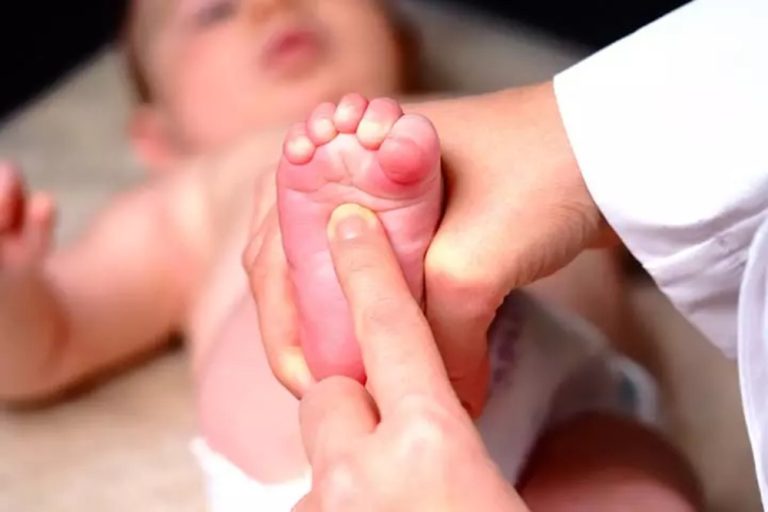 Babinski Reflex in Babies: A Comprehensive Guide for Parents